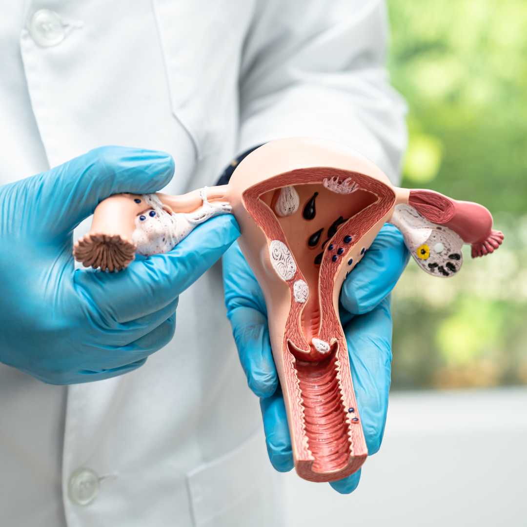 The Many Faces of PCOS | Good Living Medical Centre